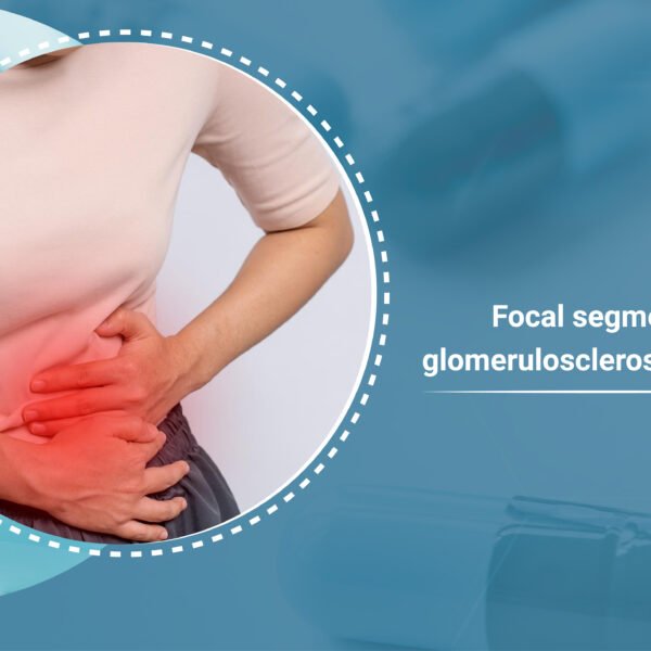 Focal Segmental Glomerulosclerosis (FSGS) in Hindi | Alfa Kidney Care
