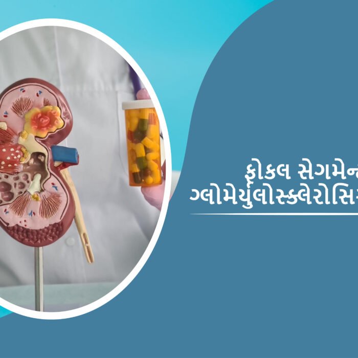 Focal Segmental Glomerulosclerosis (FSGS) in Hindi | Alfa Kidney Care